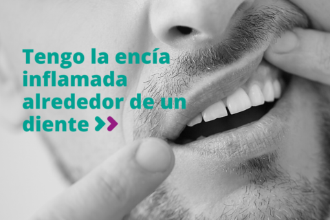 Tengo la encía inflamada alrededor de un diente | Clínica Isdent Pedrera